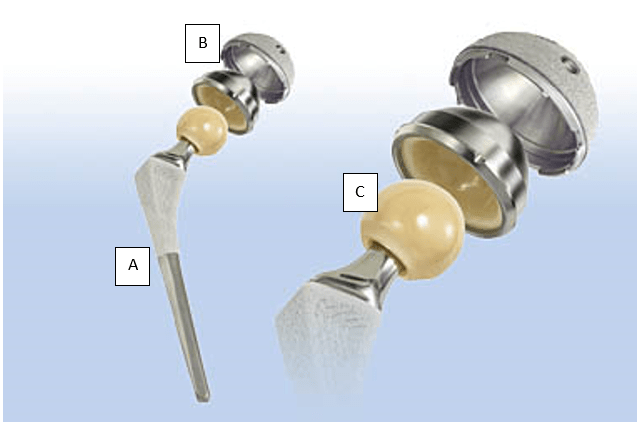 Prótese de Quadril - Saiba as orientações